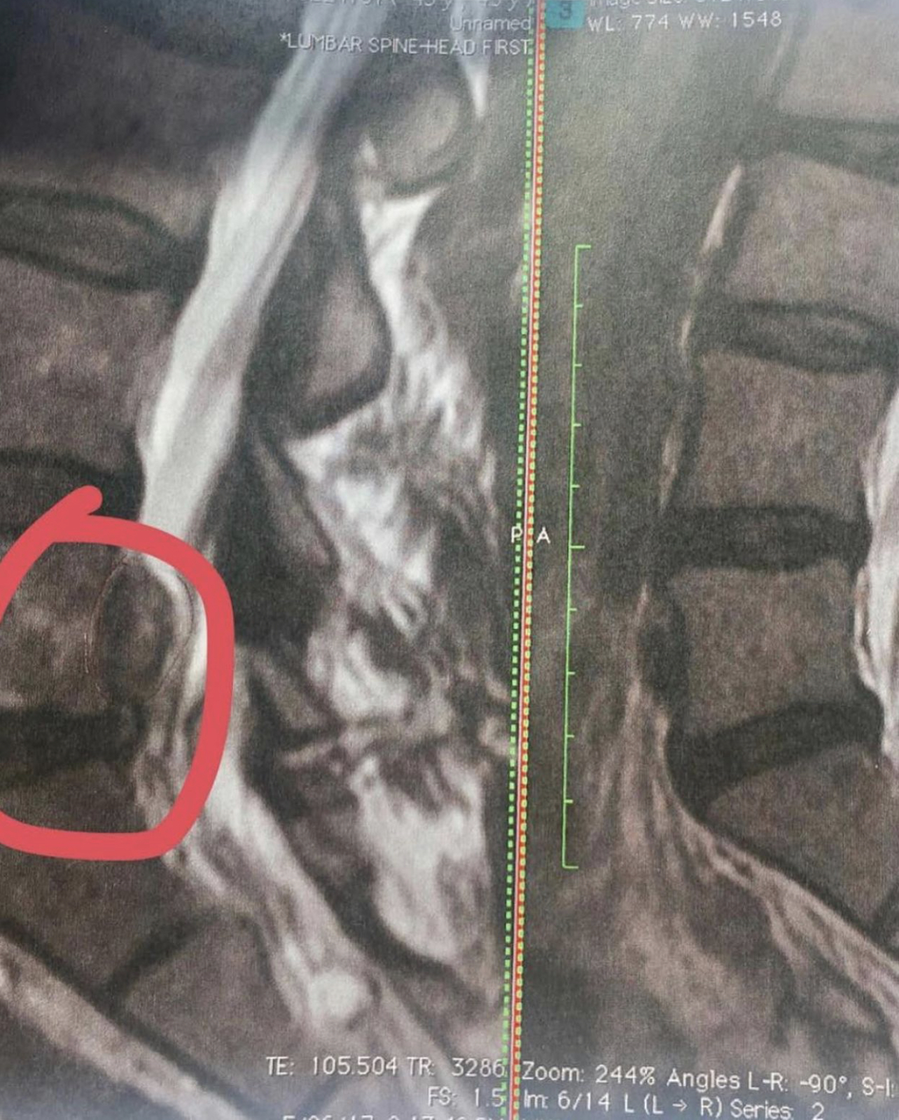 Back Pain and Underdeveloped Glutes - Natalie Jill Fitness